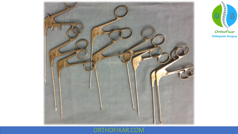 Knee Meniscus Tear Surgery | OrthoFixar 2025