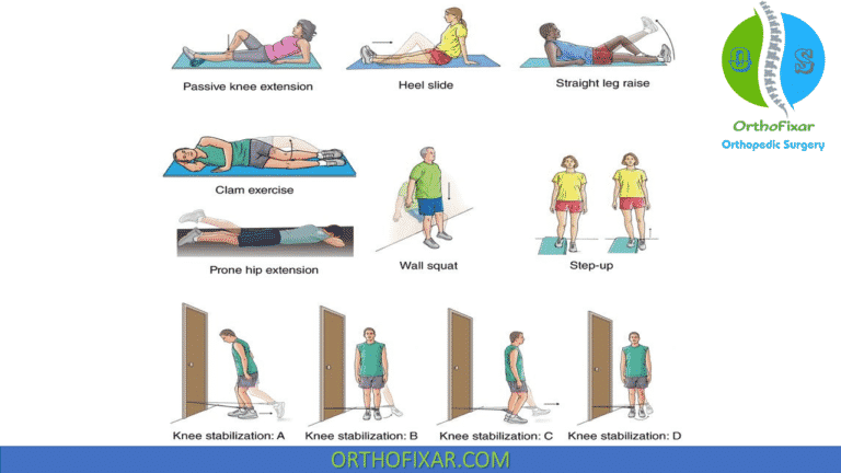 Knee LCL Sprain | OrthoFixar