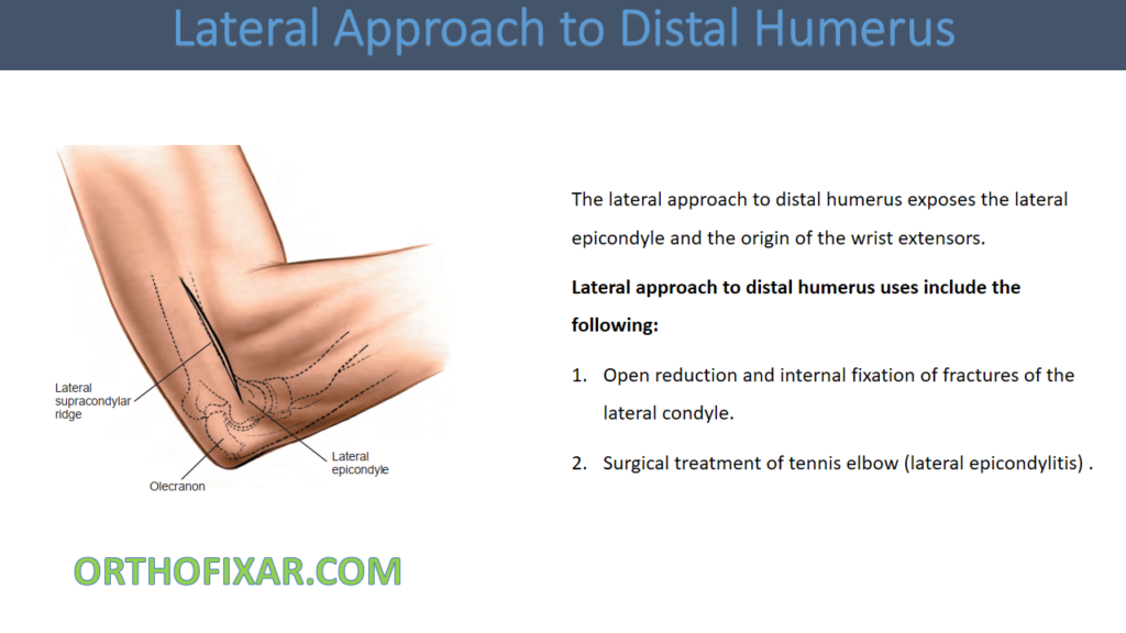 Lateral Approach To Distal Humerus Easily Explained | OrthoFixar