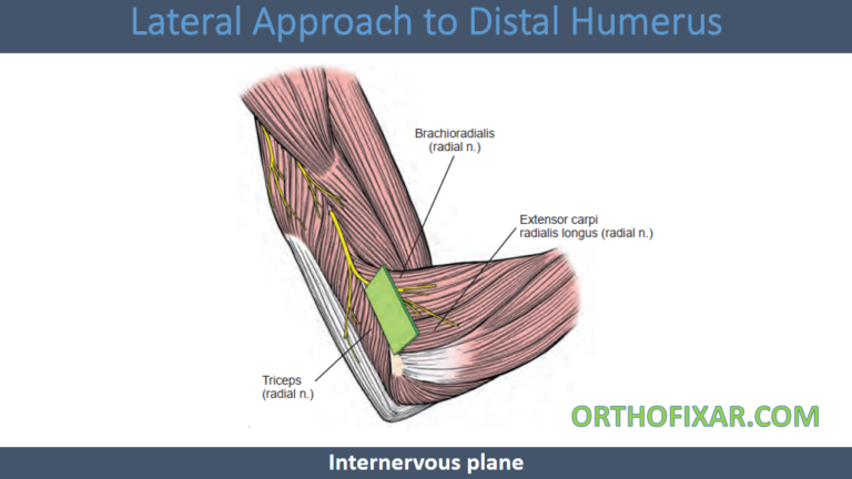 Lateral Approach To Distal Humerus Easily Explained | OrthoFixar