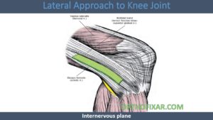 Lateral Approach To Knee Joint