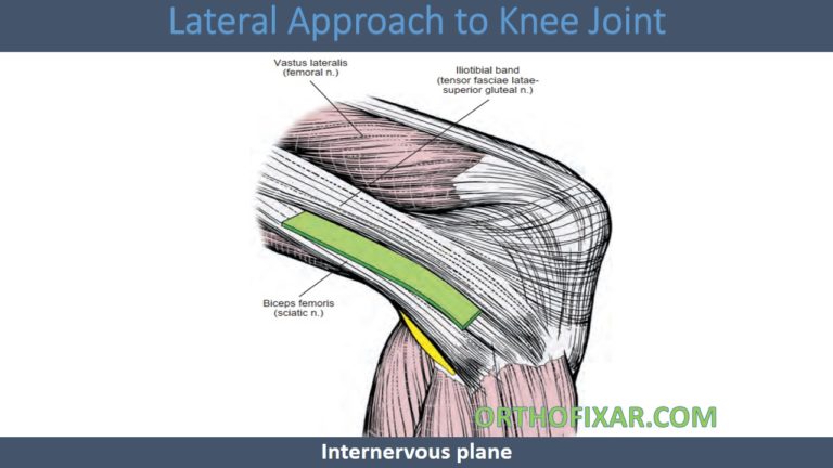 Lateral Approach To Knee Joint Easily Explained | OrthoFixar