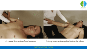 Shoulder Joint Movements Evaluation Explained Easily | OrthoFixar