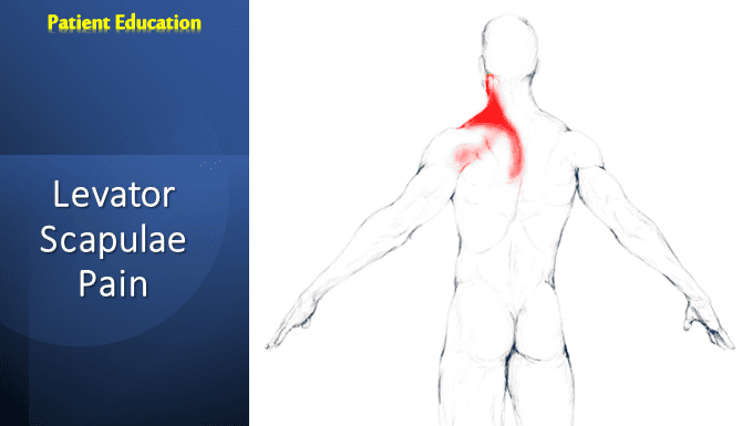 Overview Of Levator Scapulae Pain Causes & Treatment 2025