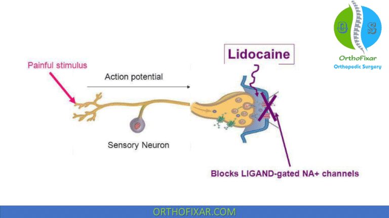Local Anesthetics | OrthoFixar