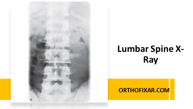 Lumbar Spine X-Ray Views | OrthoFixar