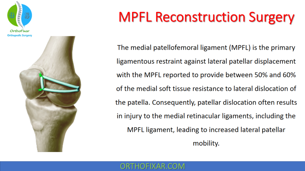 MPFL Reconstruction Surgery Easily Step-By-Step | OrthoFixar