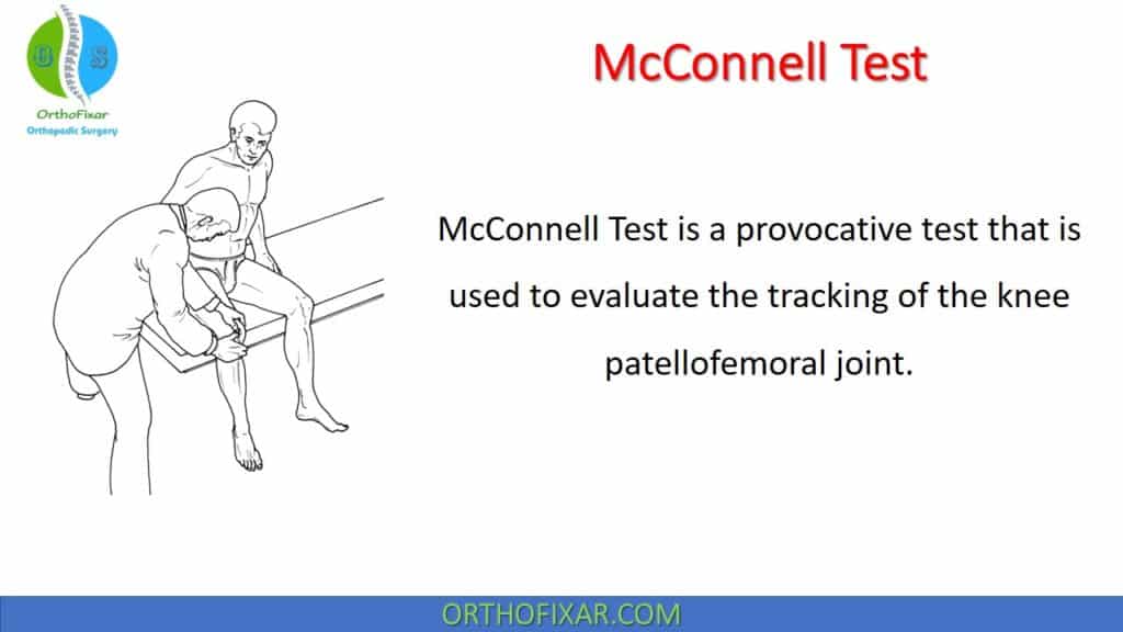 McConnell Test Explained Easily | OrthoFixar