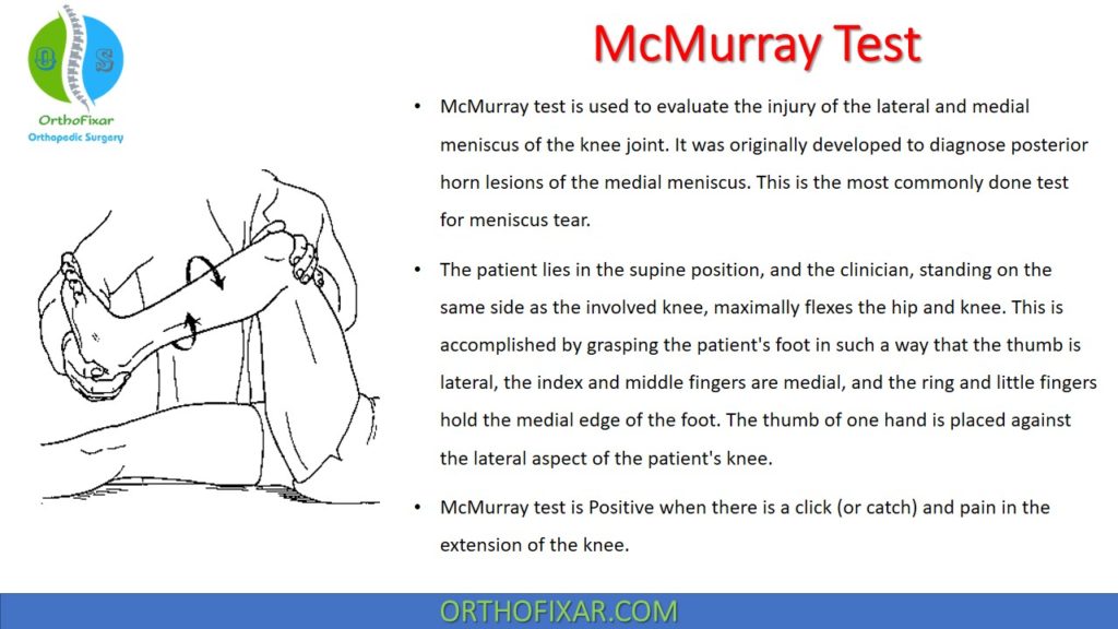 McMurray Test For Meniscus Injury | OrthoFixar 2025