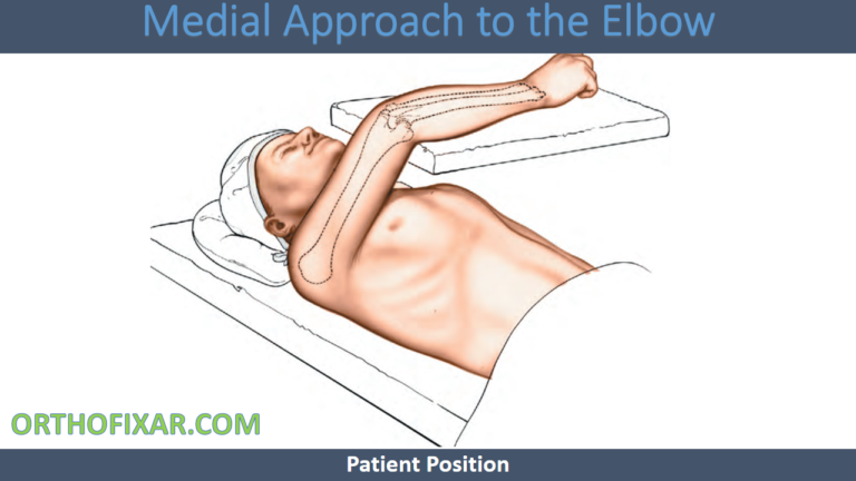 Medial Approach To The Elbow • Easy Tutorial
