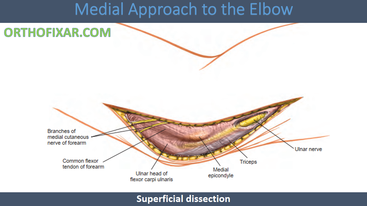 Medial Approach To The Elbow • Easy Tutorial