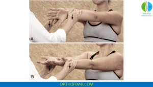 O'Brien Test | Active Compression Test Explained Easily | OrthoFixar