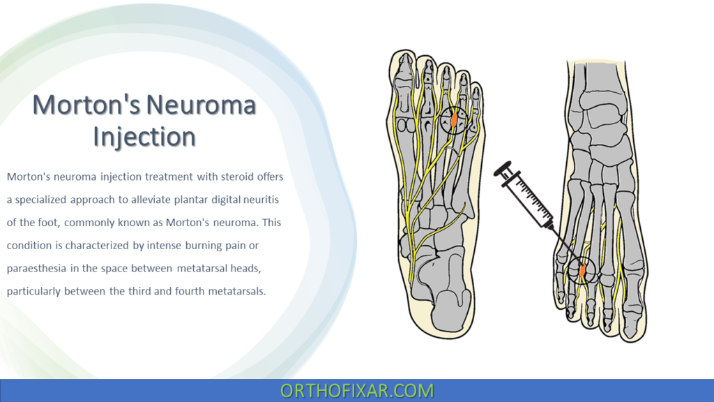 Procedure Category: Ankle & Foot Procedures | OrthoFixar
