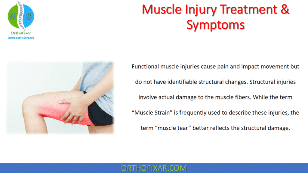 Muscle Injury Treatment & Symptoms • Easily Explained | 2025