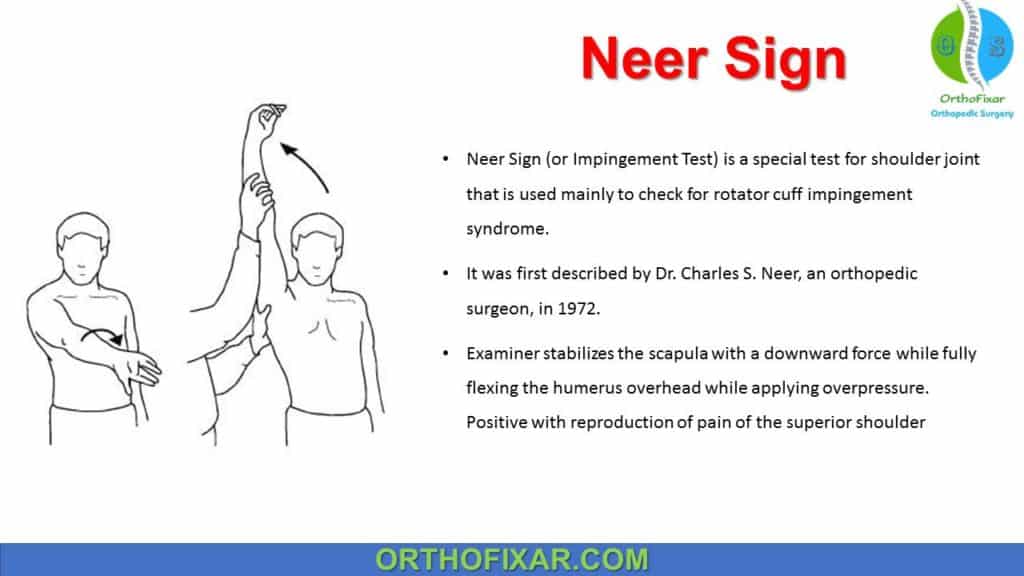 Neer Test • Easy Explained | 2025