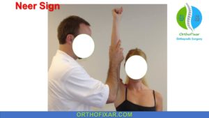 Neer Test • Easy Explained | 2025