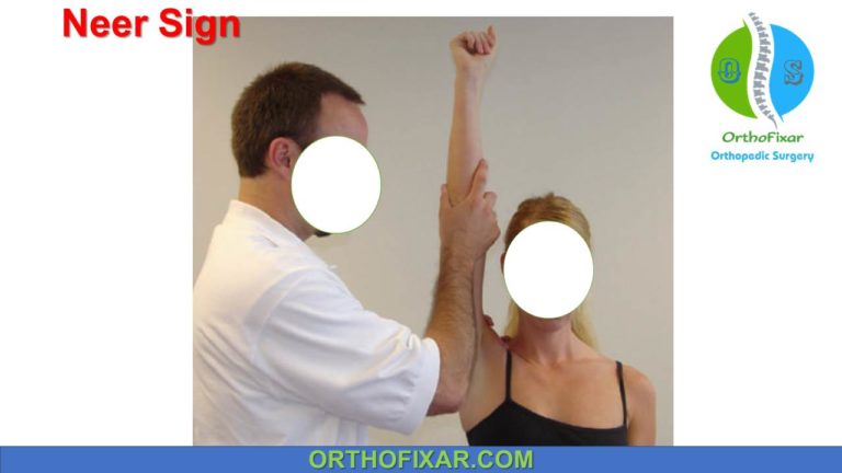 Neer Test • Easy Explained | 2025