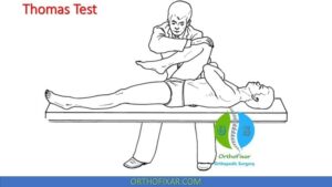 Thomas Test Definition, Technique & Reliability 2025