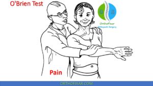 O'Brien Test | Active Compression Test