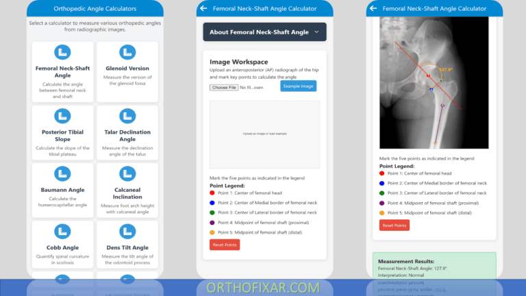 Orthopedic Angles Calculator | OrthoFixar