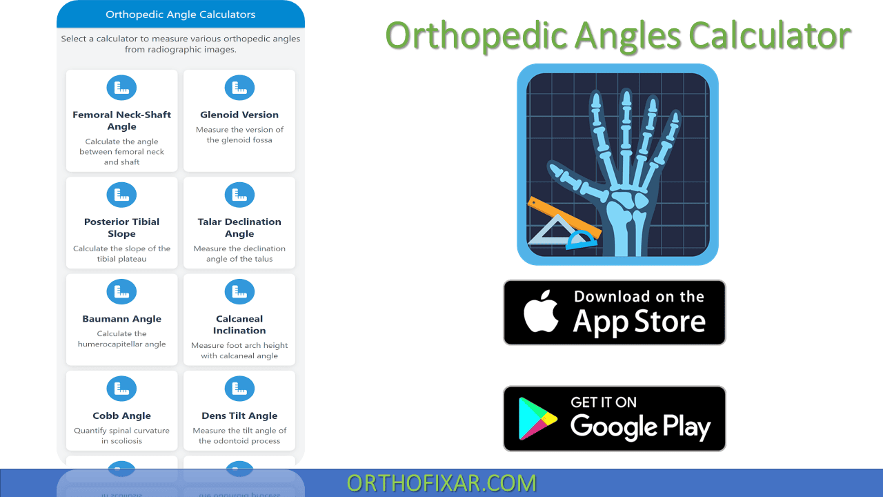Orthopedic Angles Calculator | OrthoFixar