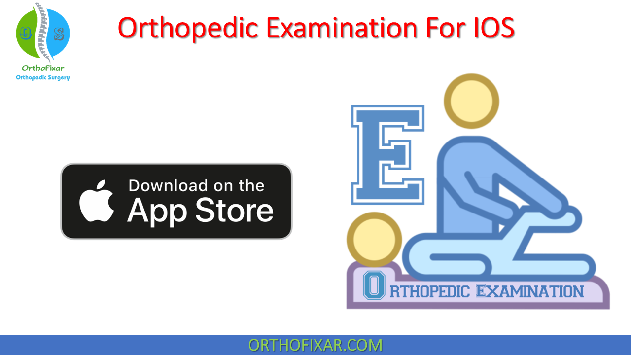 Romberg Test • Easy Explained - OrthoFixar 2022