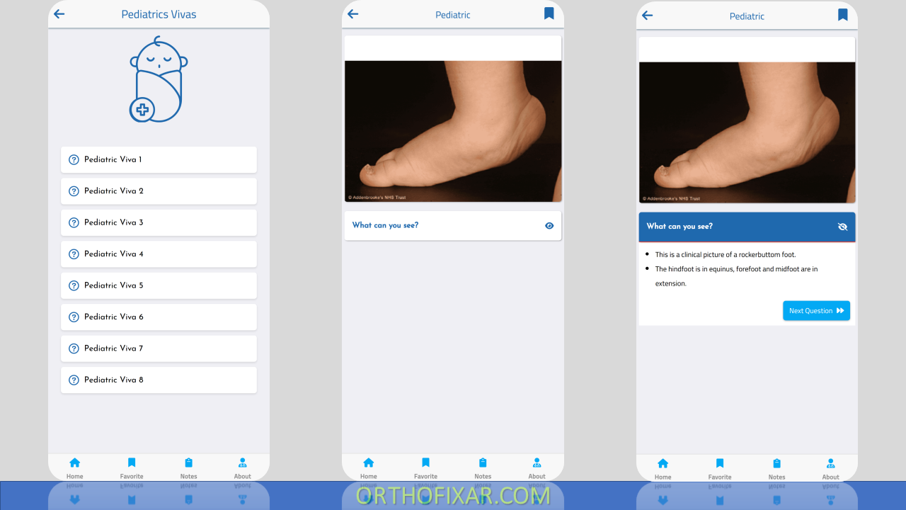 Orthopedic FRCS VIVAs Quiz Paid App | OrthoFixar