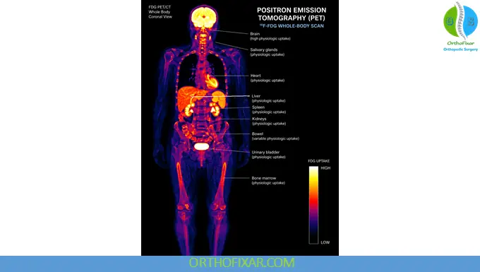 PET Scan Imaging: Principles, Procedure, Applications & Clinical Uses