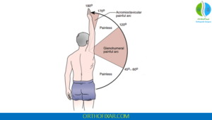 Shoulder Painful Arc Test • Easily Explained | OrthoFixar 2025