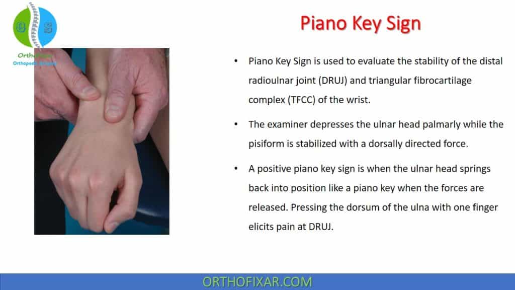 Special Test Category: Wrist & Hand Examination | OrthoFixar