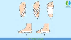 Plantar Fascia Support