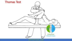 Thomas Test Definition, Technique & Reliability 2025