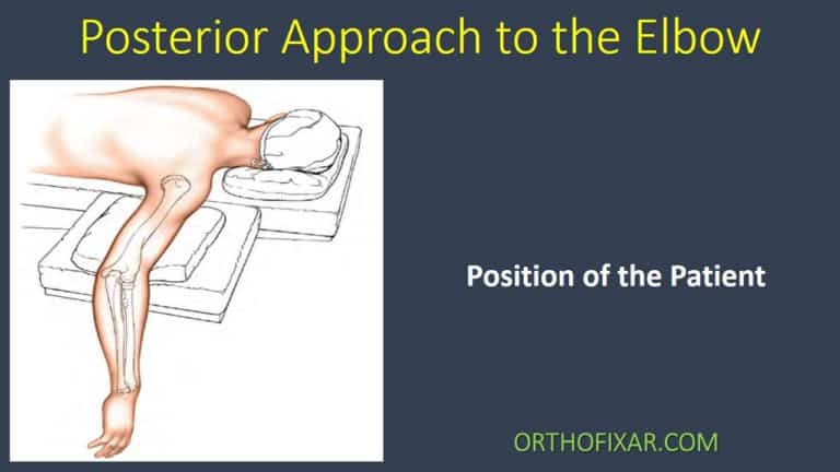 Posterior Approach To The Elbow Easily Explained | OrthoFixar