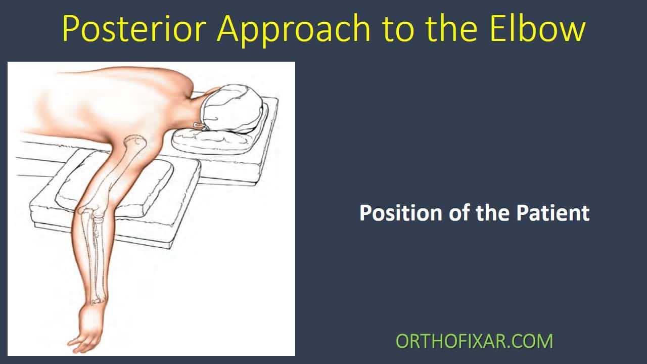 Posterior Approach To The Elbow Easily Explained | OrthoFixar