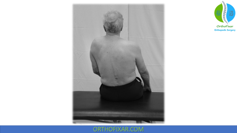Postural Alignment Assessment Explained Easily | OrthoFixar