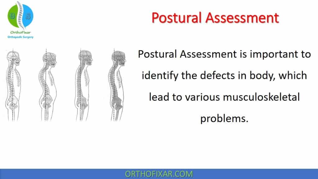 Postural Assessment Explained Easily | OrthoFixar
