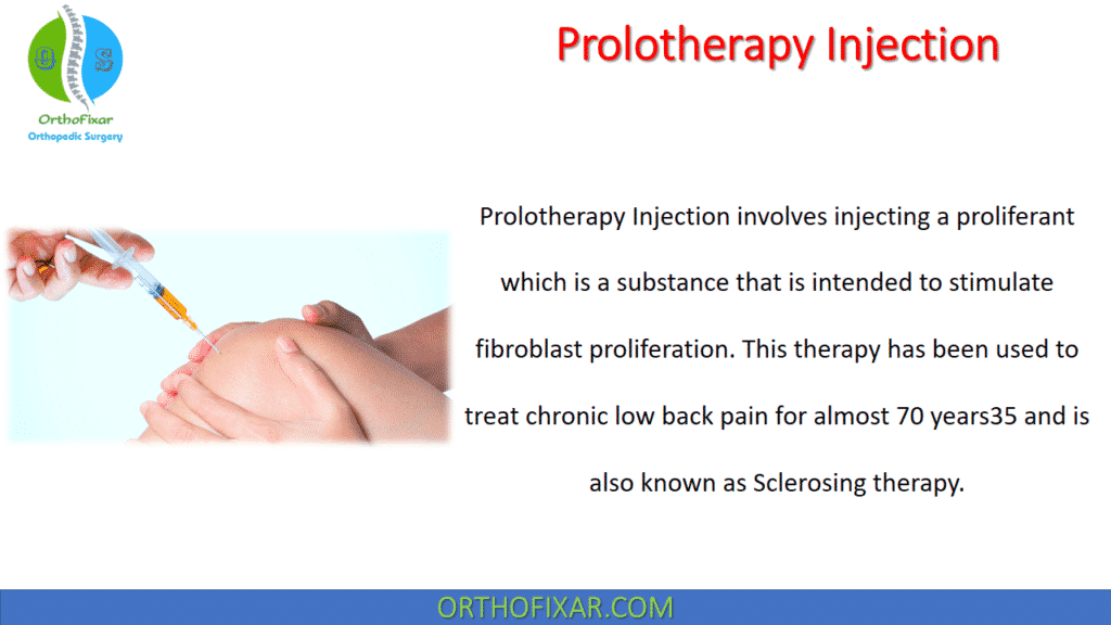 Prolotherapy Injection | OrthoFixar