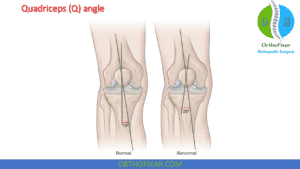 Patellofemoral Joint