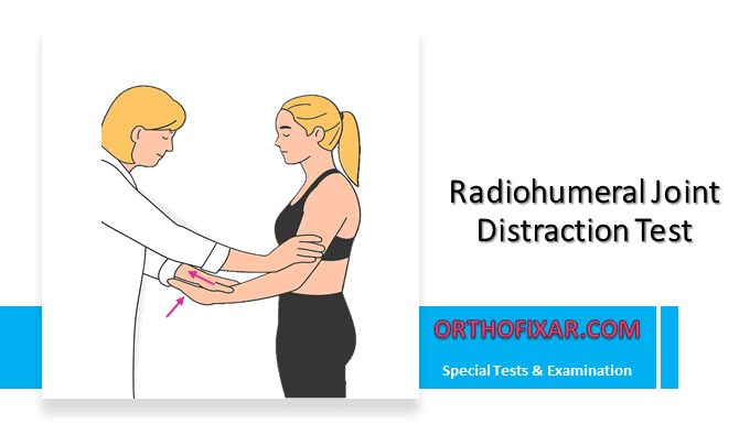 S1 Nerve Root Examination | OrthoFixar 2025