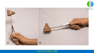 Deep Tendon Reflex Testing Explained Easily | OrthoFixar