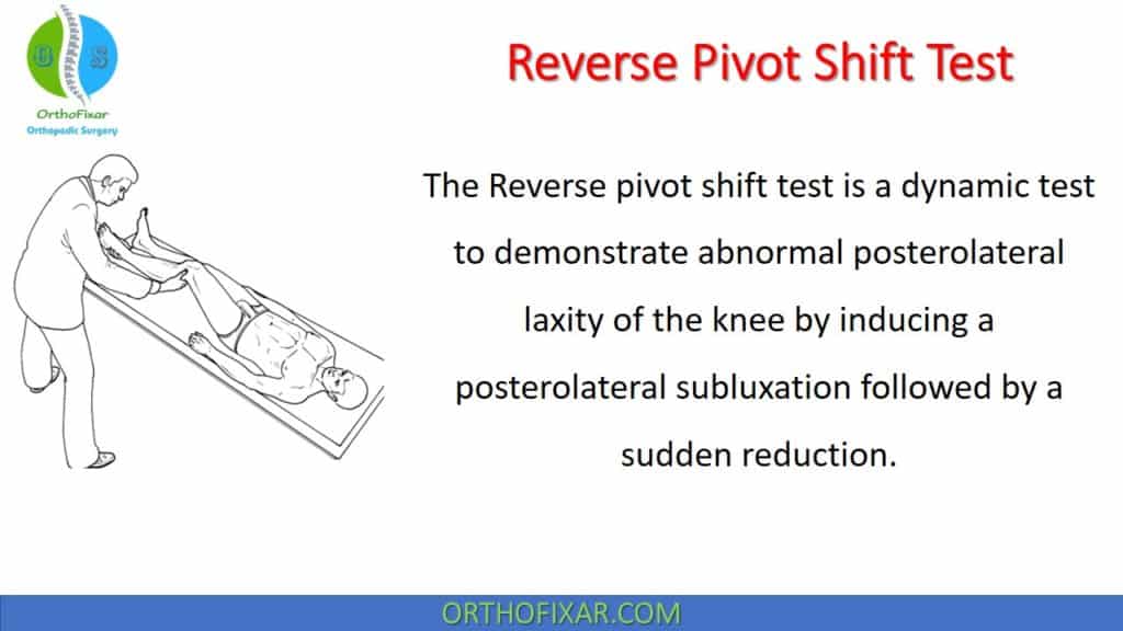 Reverse Pivot Shift Test Explained Easily | OrthoFixar
