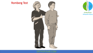 Romberg Test Procedure Overview 2025