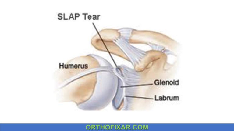 Crank Test Explained Easily | OrthoFixar
