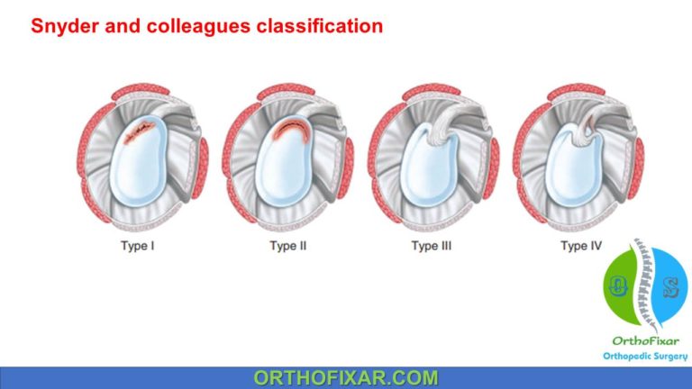 Crank Test Explained Easily | OrthoFixar