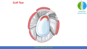 Shoulder Anterior Slide Test Explained Easily | OrthoFixar