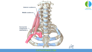 Scalene Muscles Anatomy | OrthoFixar