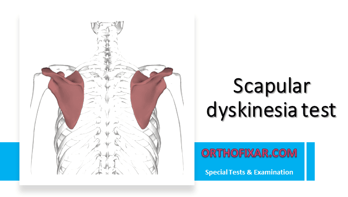 Mill's Test | Lateral Epicondylitis Assessment | OrthoFixar 2024