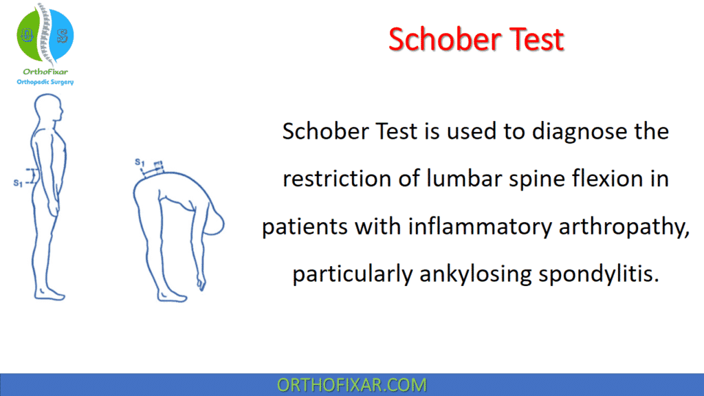 Schober Test Explained Easily | OrthoFixar