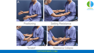 Scratch Collapse Test Explained Easily | OrthoFixar