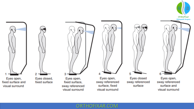 Sensory Organization Test